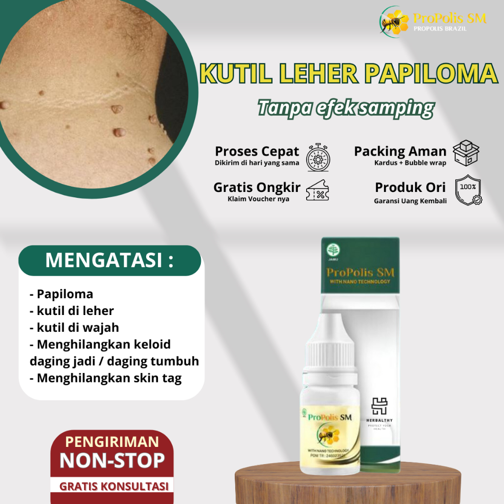 Jual Obat Penghilang Kutil Mata Ikan dan Papiloma di Leher Wajah Kaki ...