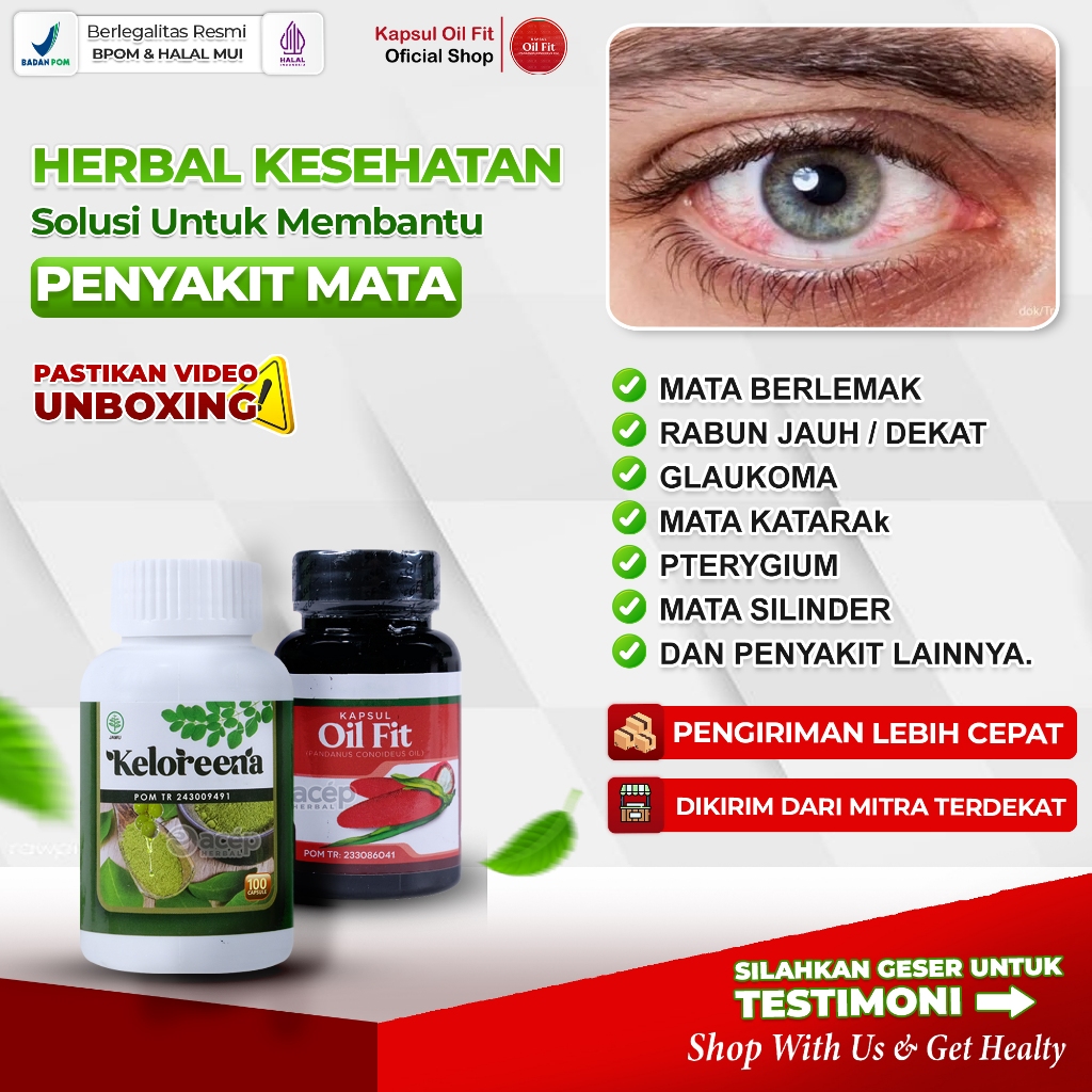 Jual Obat Mata Minus Dan Silinder Pembersih Pterygium Mata Berlemak ...