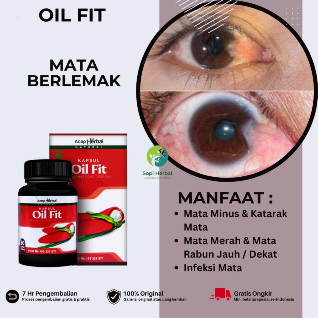 Jual Oil Fit Kapsul - Mata Berlemak Kekuningan, Penyakit Pterigium ...