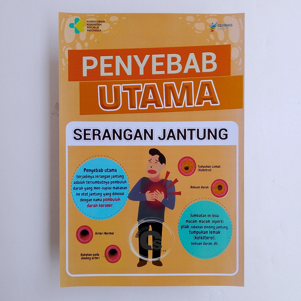 Jual Poster Penyebab Utama Serangan Jantung - Poster Kesehatan | Shopee ...