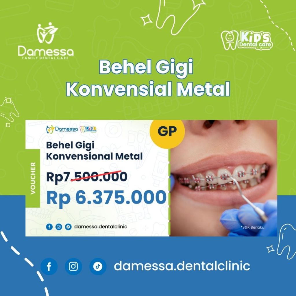 Jual Voucher Behel Gigi Damessa - Pasang Behel Gigi Konvensional Metal with General Dentist ...
