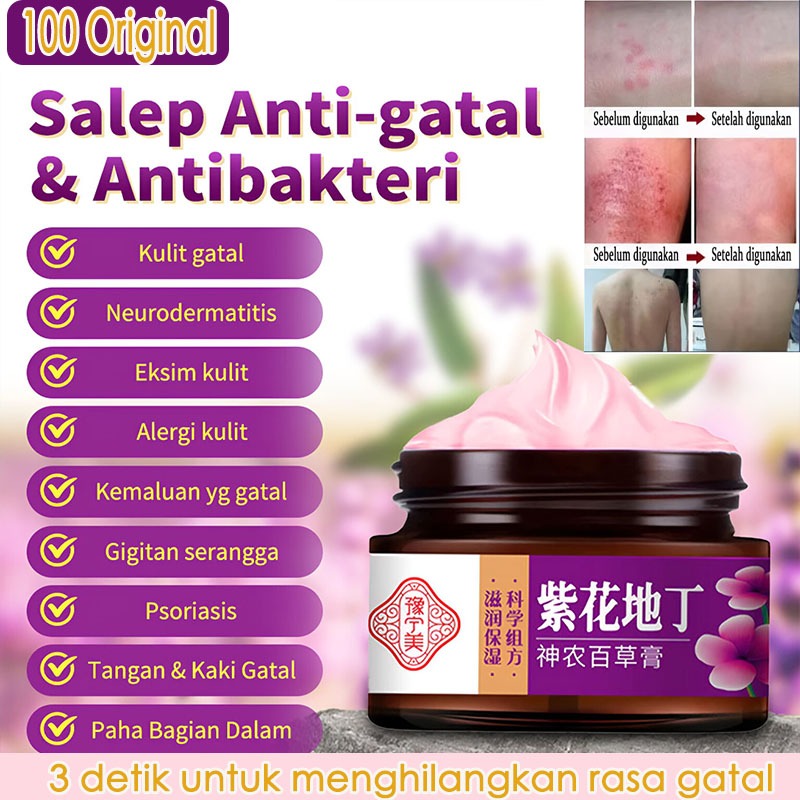 Jual [Original] Salep anti gatal paling ampuh untuk kulit gatal eksim ...