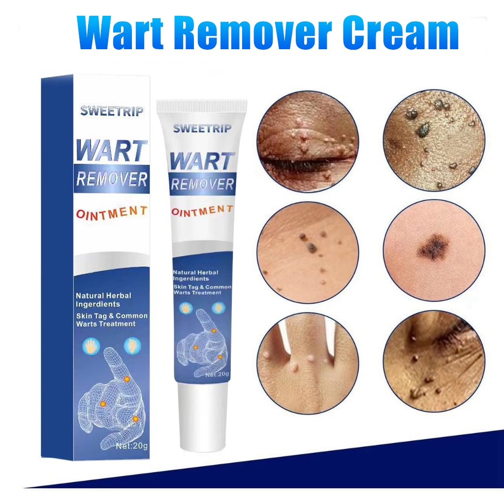 Jual Wart Removal Cream Skin Tag Remover 20g Menghilangkan Kutil Tahi ...
