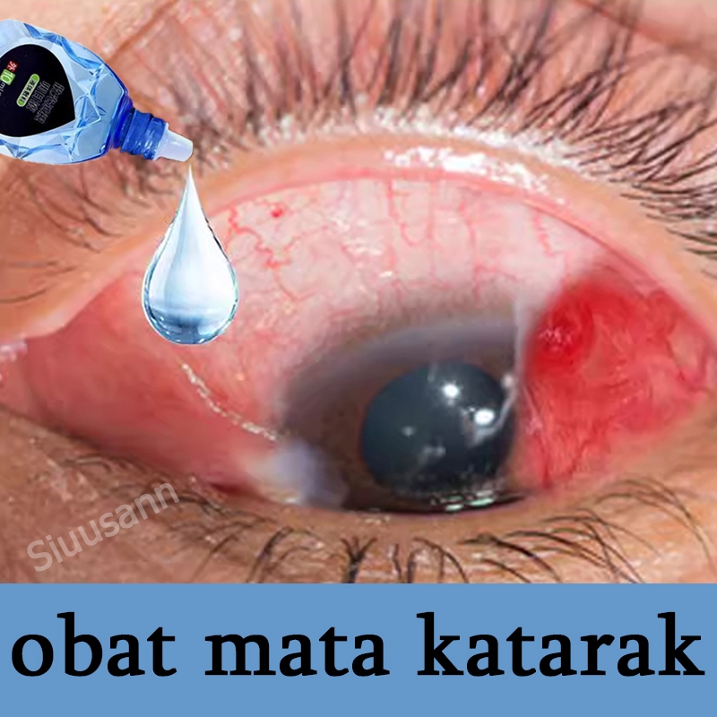 Jual obat mata katarak obat mata berlemak mata kering sakit mata darah ...