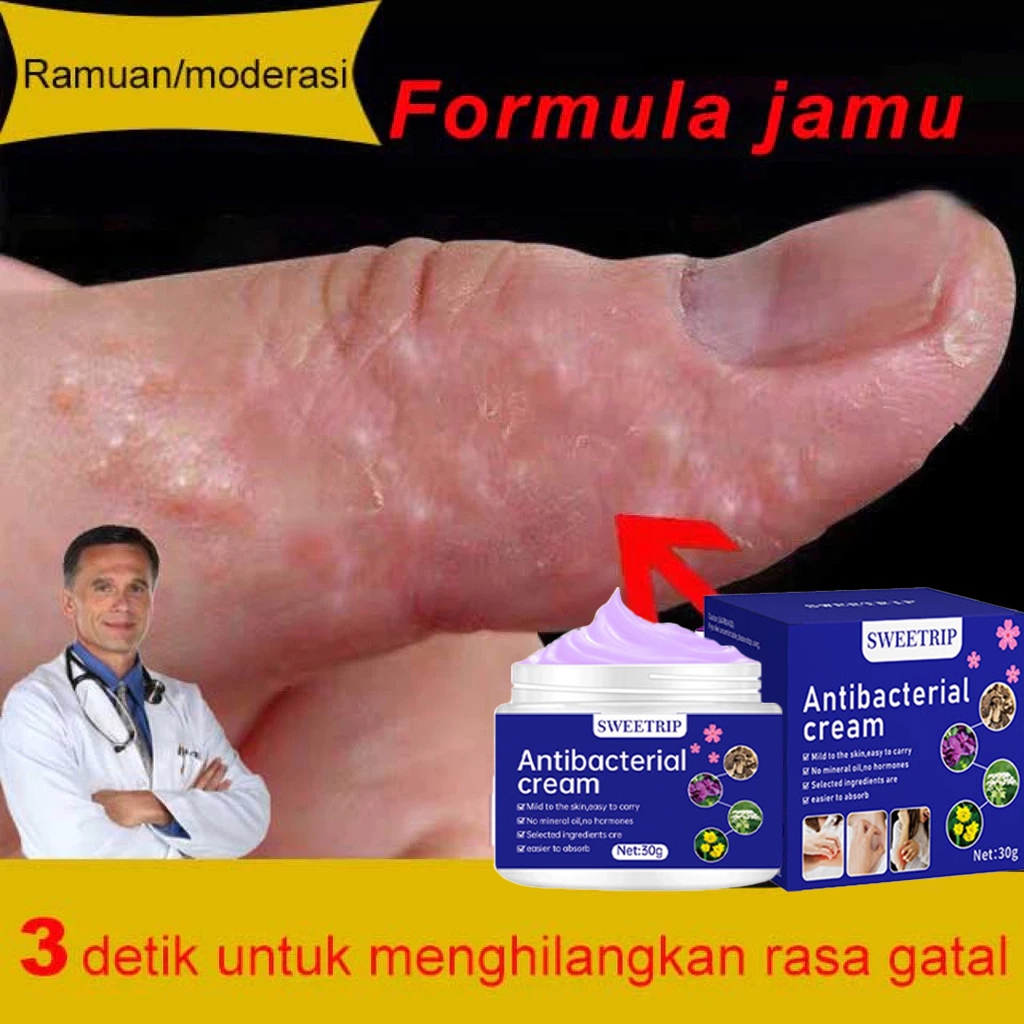 Jual [Original 100%] Krim Gatal Salep Gatal Psoriasis Salep Kulit Jamur ...
