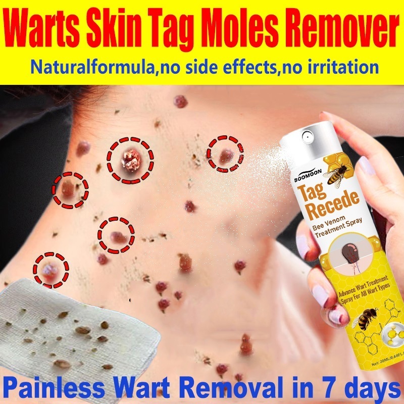 Jual Penghilang tahi lalat di wajah Penghilang kutil di leher Wart ...