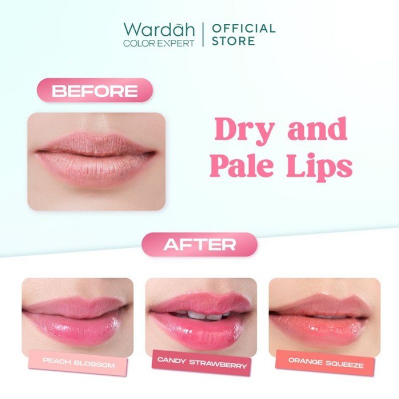 Jual WARDAH HYDRA BALM LIP BALM SPF 15 LIP CARE | Shopee Indonesia