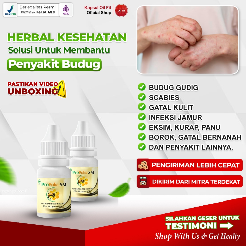 Jual Obat Oles Budug Bernanah Kulit Gatal Selangkangan Panu Kadas Kurap ...