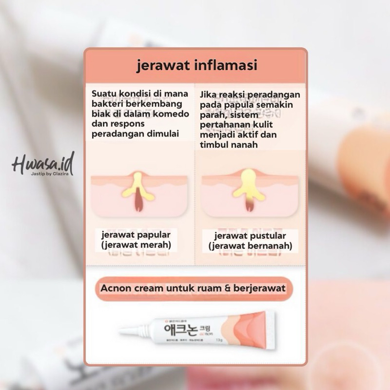 Jual READY STOCK ACNE CREAM KOREA, OBAT TOTOL JERAWAT | Shopee Indonesia