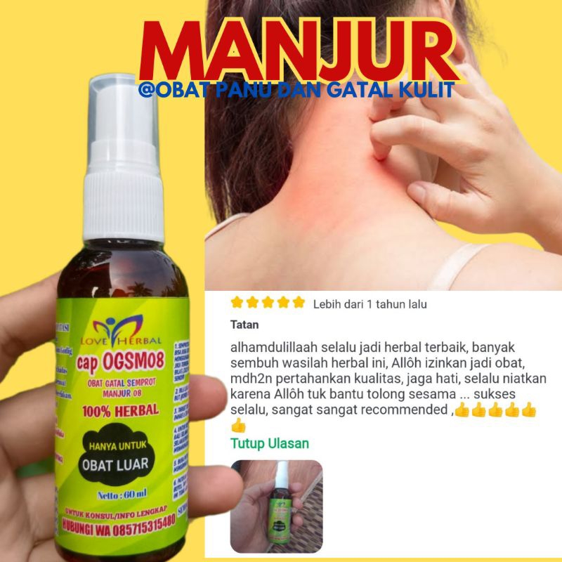 Jual Obat Panu, Obat gatal kulit, kurap kudis super ampuh ogsm08 ...