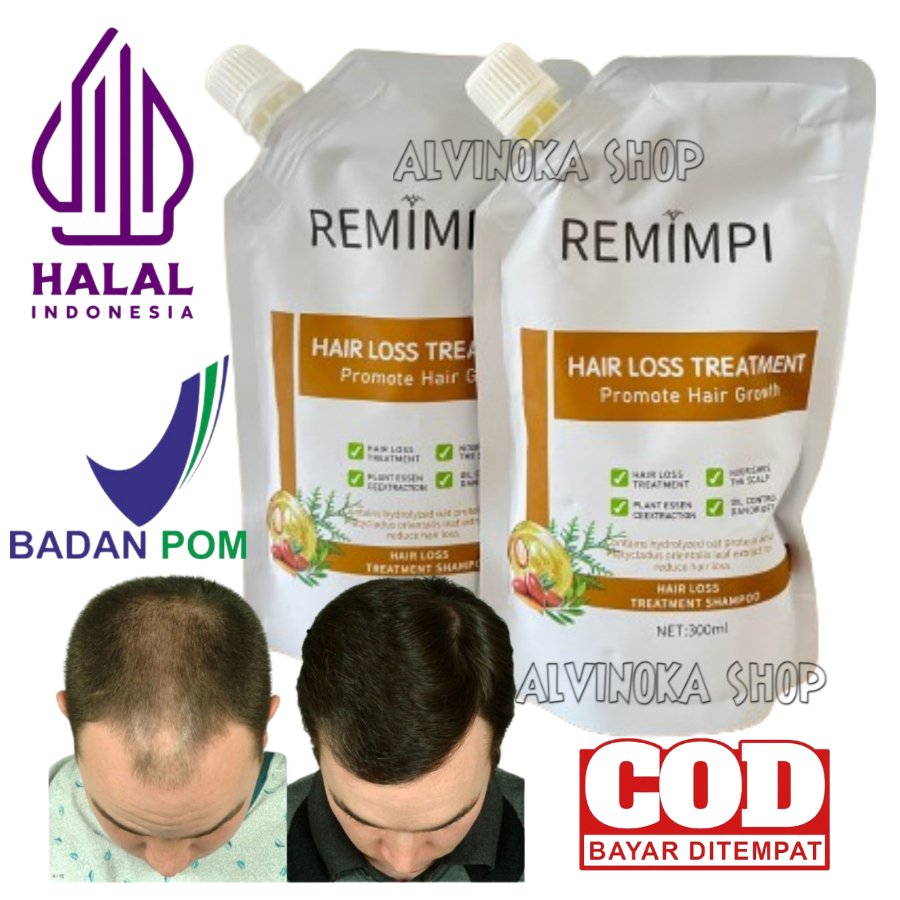 Jual Shampo Rambut Rontok Ketombe Terlengkap & Harga Terbaru Juni 2026 ...