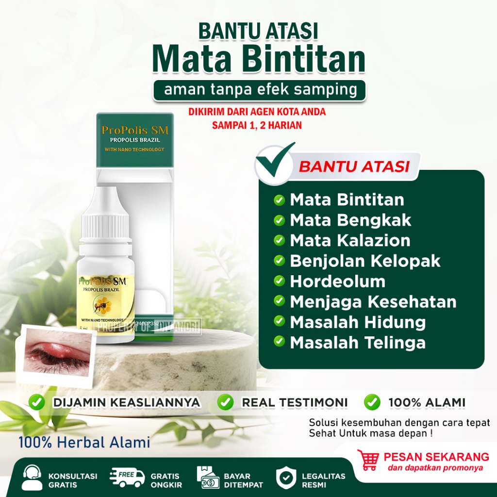 Jual Obat Mata Bintitan Mata Kalazion Mata Bengkak Mata Hordeolum ...