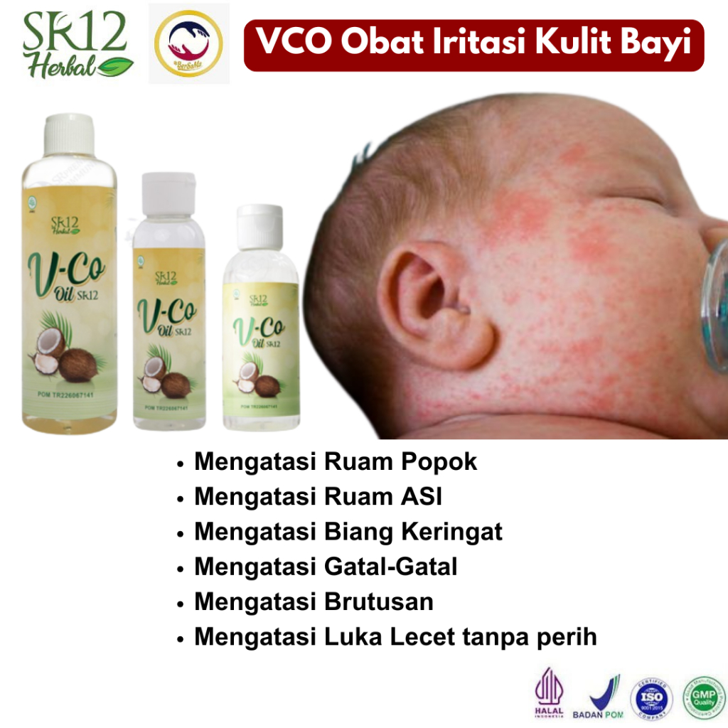 Jual Minyak Kelapa Virgin Coconut Oil Obat Oles untuk Ruam Pipi dan ...