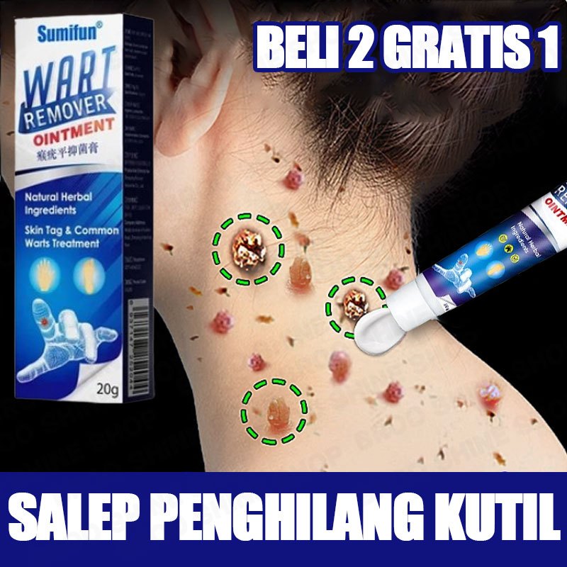 Jual Obt Kutil Krim Penghilang Kutil Di Wajah Dan Leher Salep Kutil ...