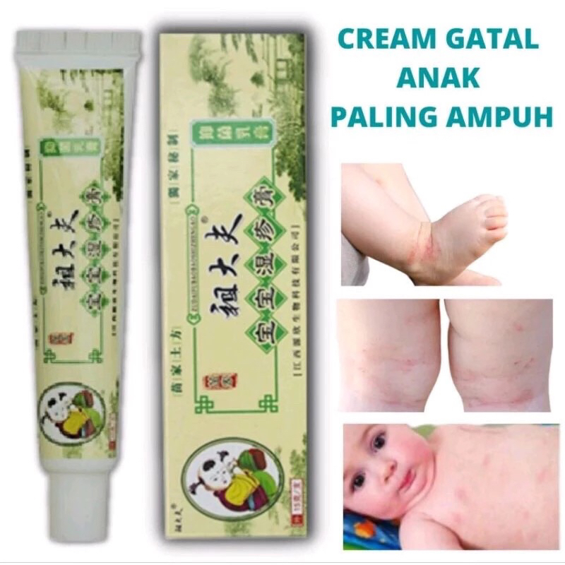 Jual Salep Zuda1fu Obat Gatal bayi Anak-Anak Balita Obat Eksim Obat ...