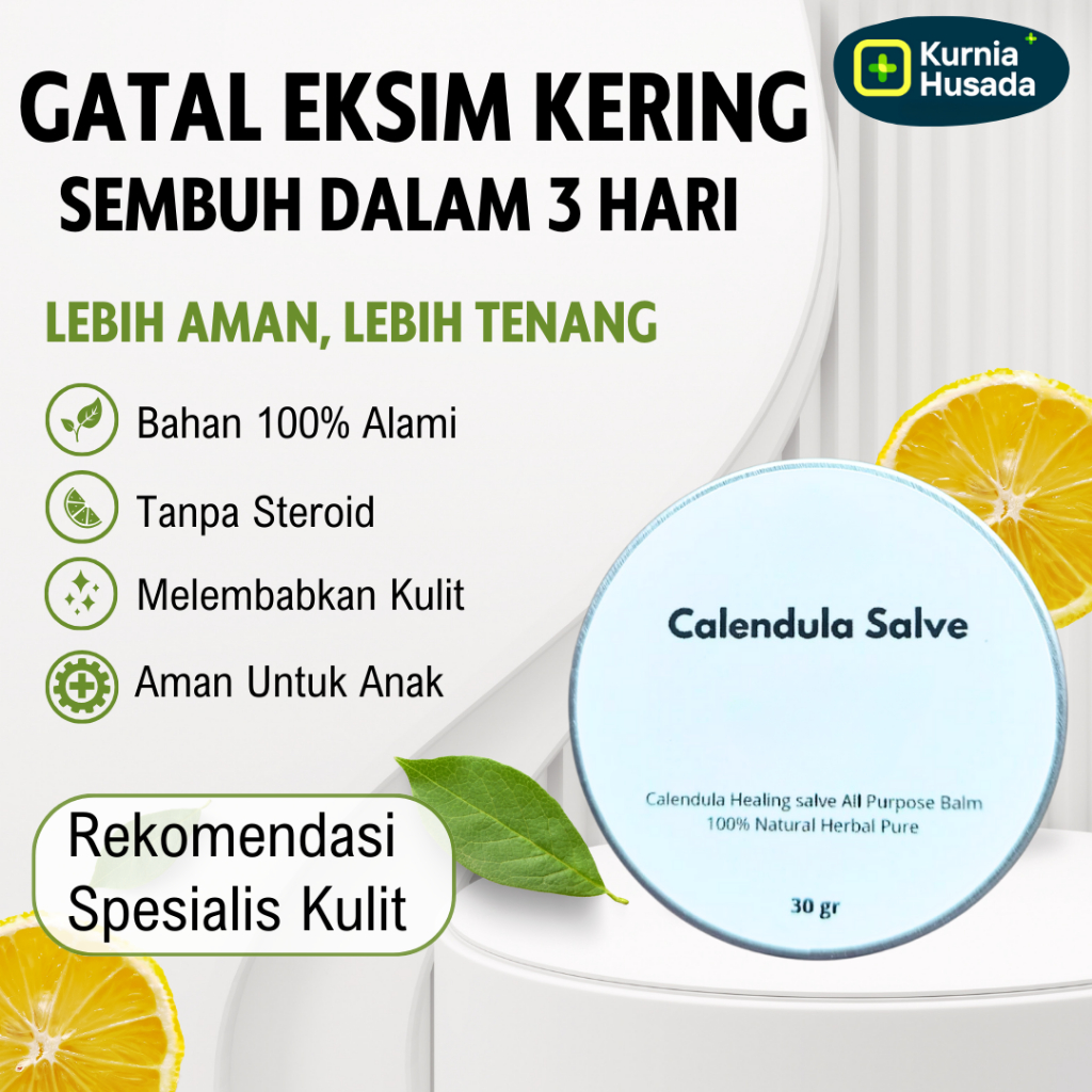Jual Calendula salve 30gr untuk eksim gatal gatal ruam popok kulit ...