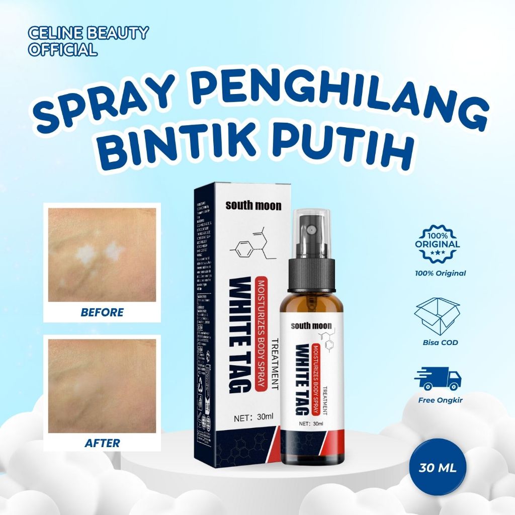 Jual South Moon White Tag remover spray Moisturizing Reduces White ...