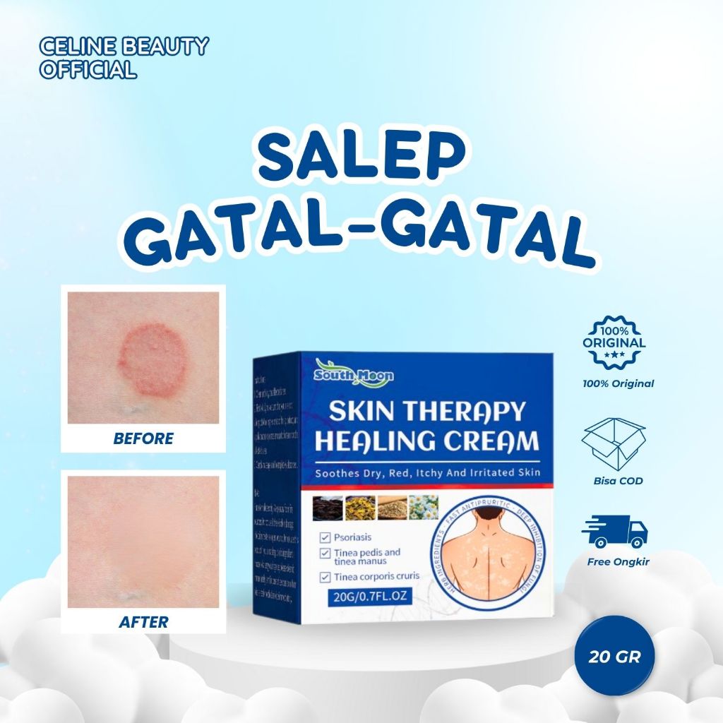 Jual South Moon Skin Therapy Healing Skin Cream 20g Salep Gatal Paling ...