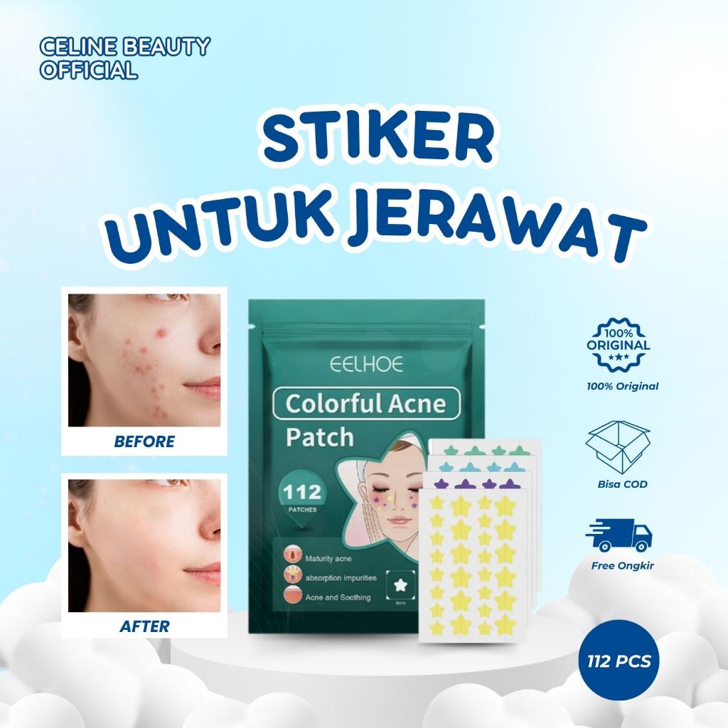 Jual Acne Patch Karakter Pimple Patch Star Merah Jambu Hijau Ungu Biru ...