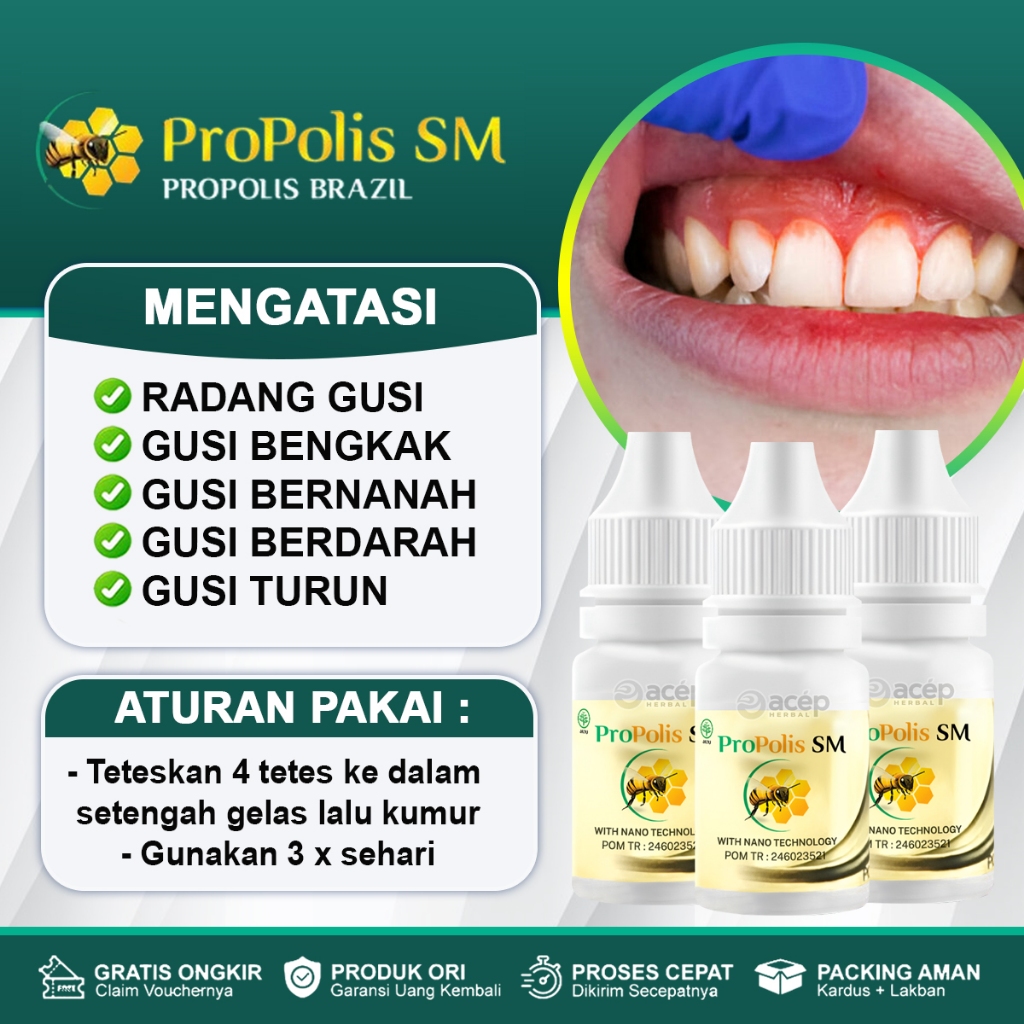 Jual Obat Radang Gusi, Obat Gusi Turun, Obat Gusi Bengkak, Obat Gusi ...