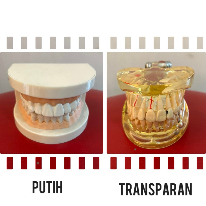 Jual Model Gigi Edukasi / Patung Gigi / Model Study Gigi / Dental Study ...