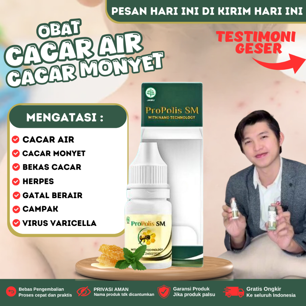 Jual Propolis SM - Obat cacar air & bekas cacar, Obat herpes zoster ...