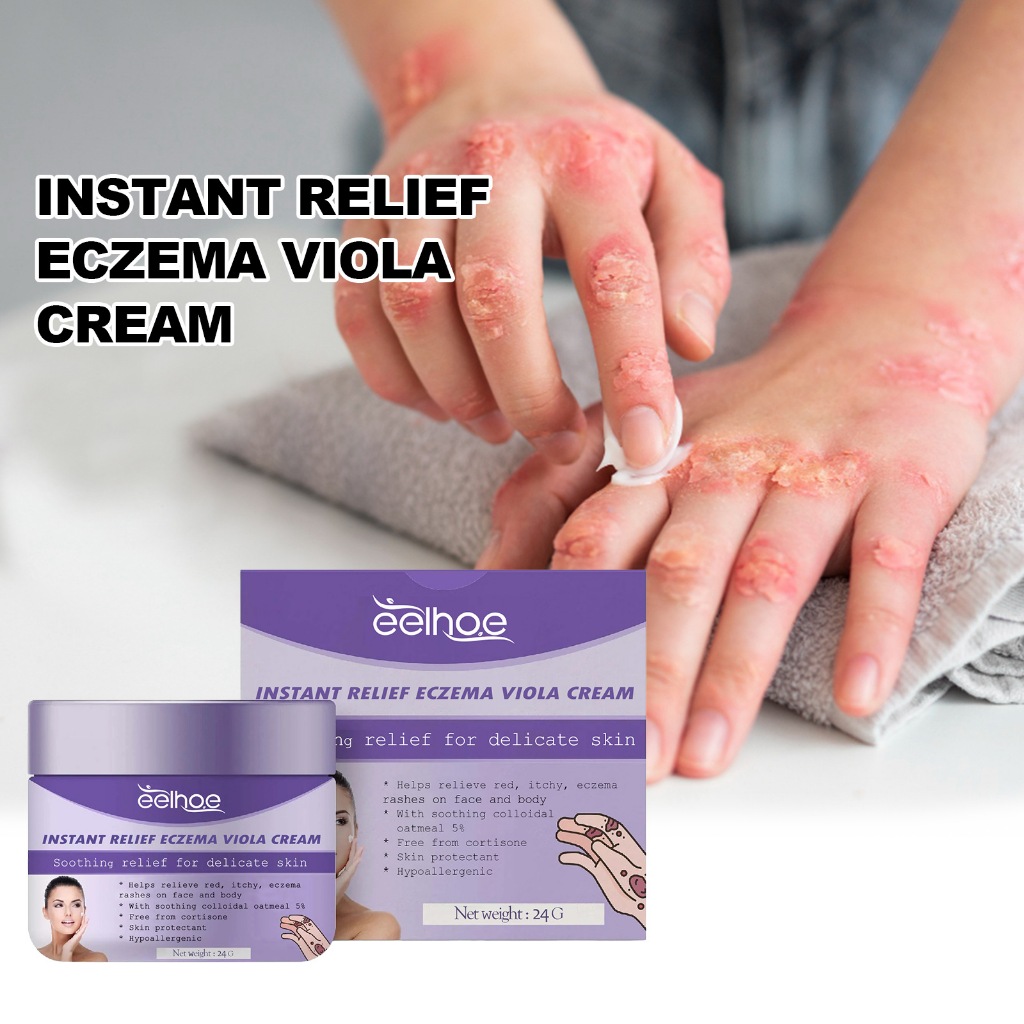 Jual Psoriasis Repair Cream Anti Itch Antibacterial Inhibits Skin ...