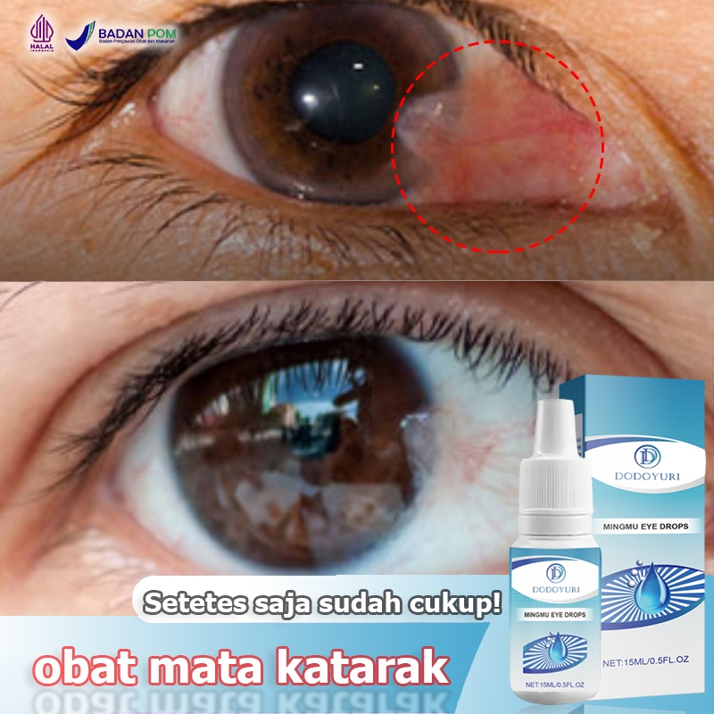 Jual Obat mata katarak Obat mata minus Obat tetes mata Tetes mata 15ml ...