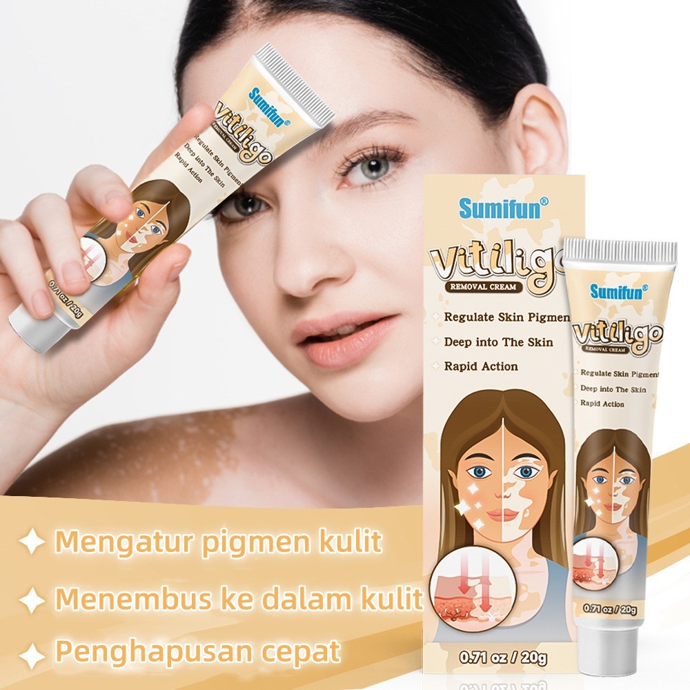 Jual 100% Asli Salep vitiligo Salep bintik putih khusus vitiligo cepat ...