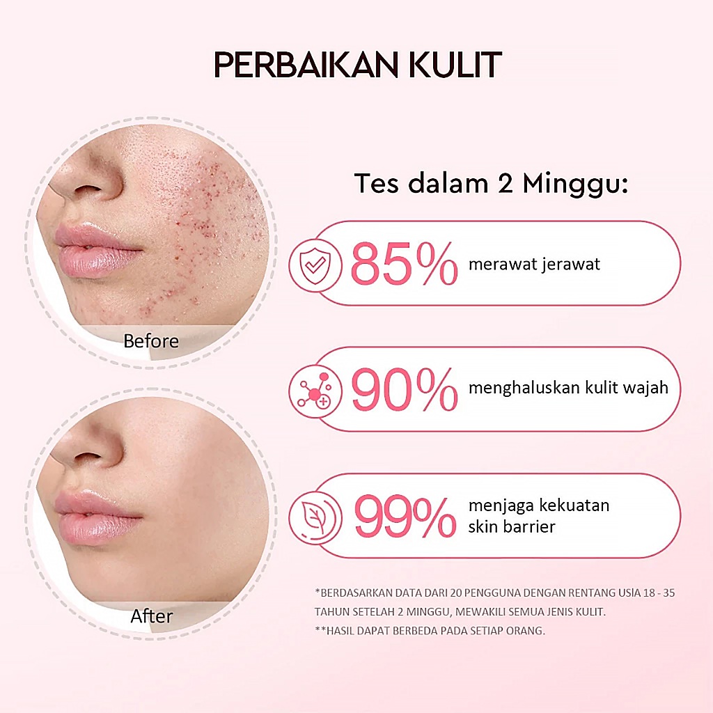 Jual GLAD2GLOW - PEACH RETINOL SERUM ( 17 ml ) - Serum Wajah Skin ...