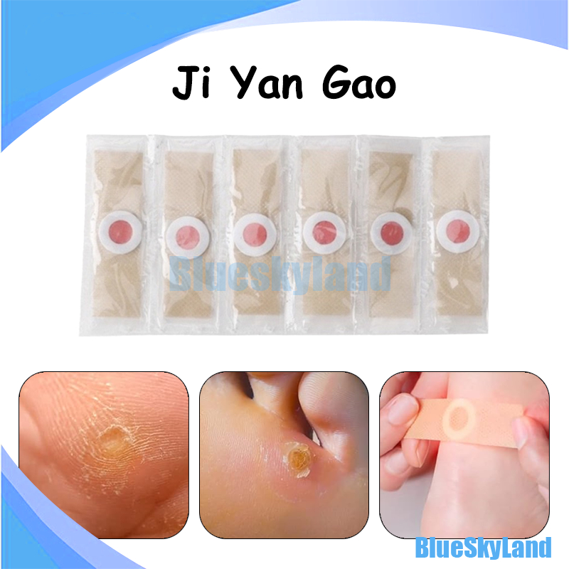 Jual Plester Obat Mata Ikan 6PCS/18Pcs Mata Ikan Foot Corn Removal ...