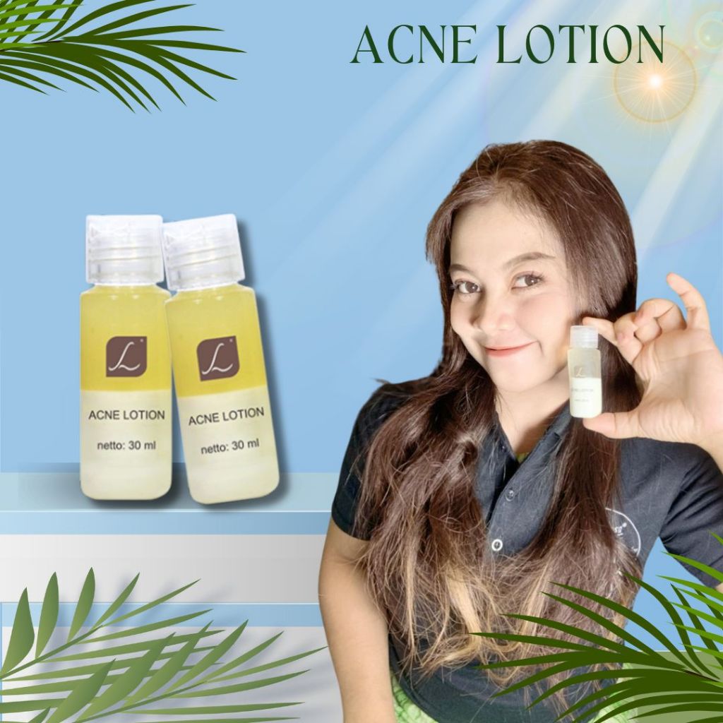 Jual LARISSA ACNE LOTION - OBAT JERAWAT | Shopee Indonesia