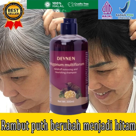 Jual Shampoo Penghitam 300ml Rambut Shampo Uban Permanen Original ...