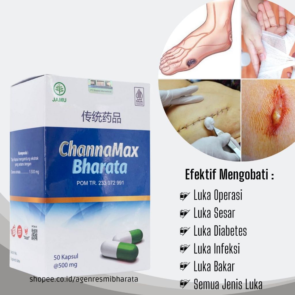 Jual Obat Luka Ampuh Original | Obat Luka Diabetes Gula Obat Luka ...