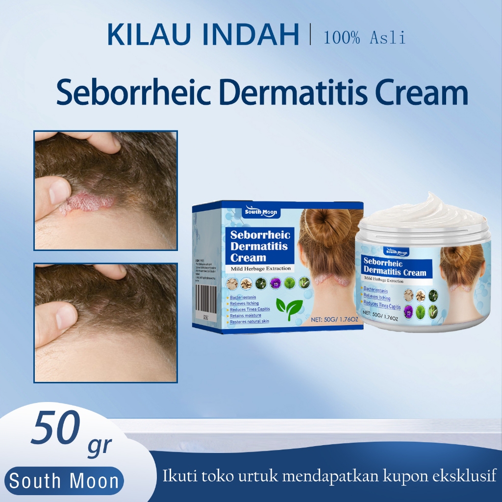 Jual South Moon Seborrheic Dermatitis Cream 50g Krim Kulit Gatal Obat ...