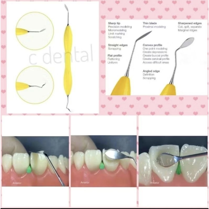 Jual Dental Solo Anterior Esthetic Veneer Composite Filling Instrument ...