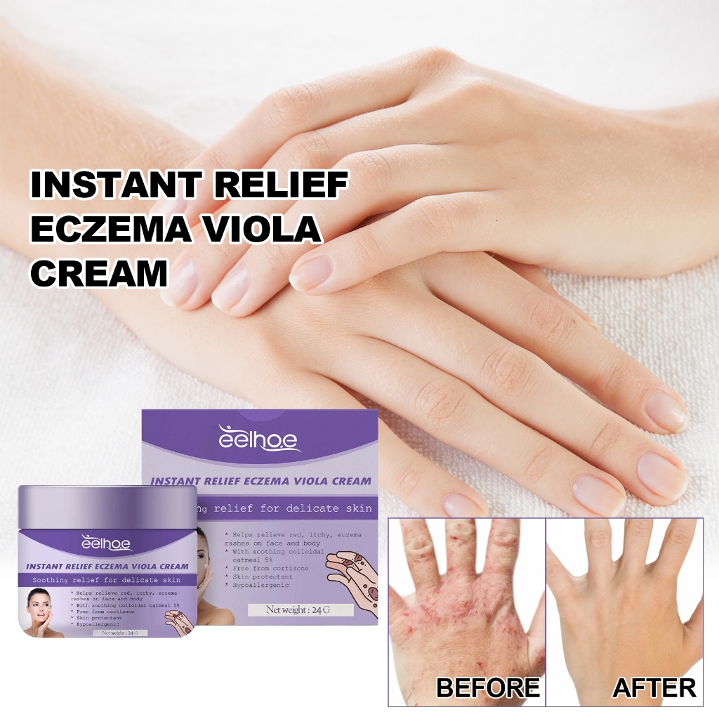 Jual EELHOE Skin Repair Cream, Memperbaiki Kaki dan Tangan yang Terkena ...