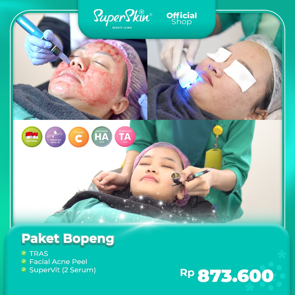 Jual Superskin Paket Bopeng - Menghilangkan Bopeng: Treatment TRAS ...