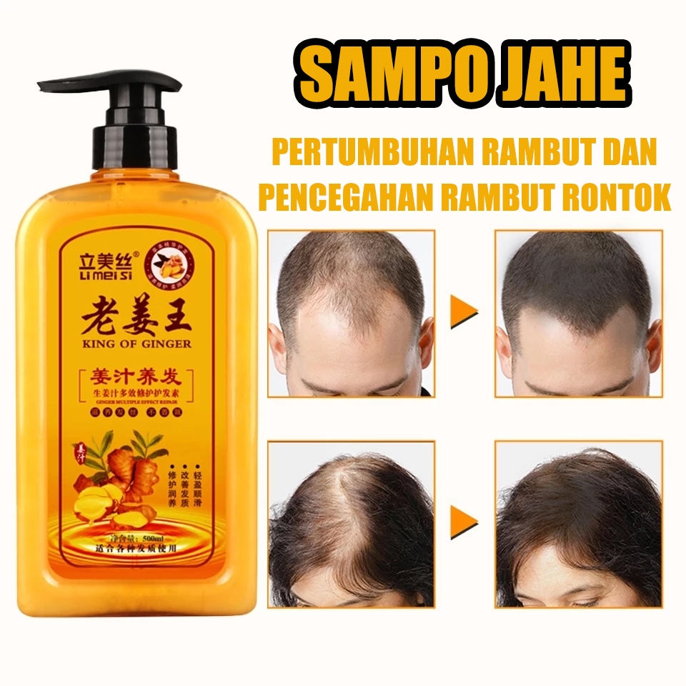Jual 300ml Shampo Penumbuh Rambut Cepat Ginger Shampoo pertumbuhan rambut Pengendalian Minyak ...