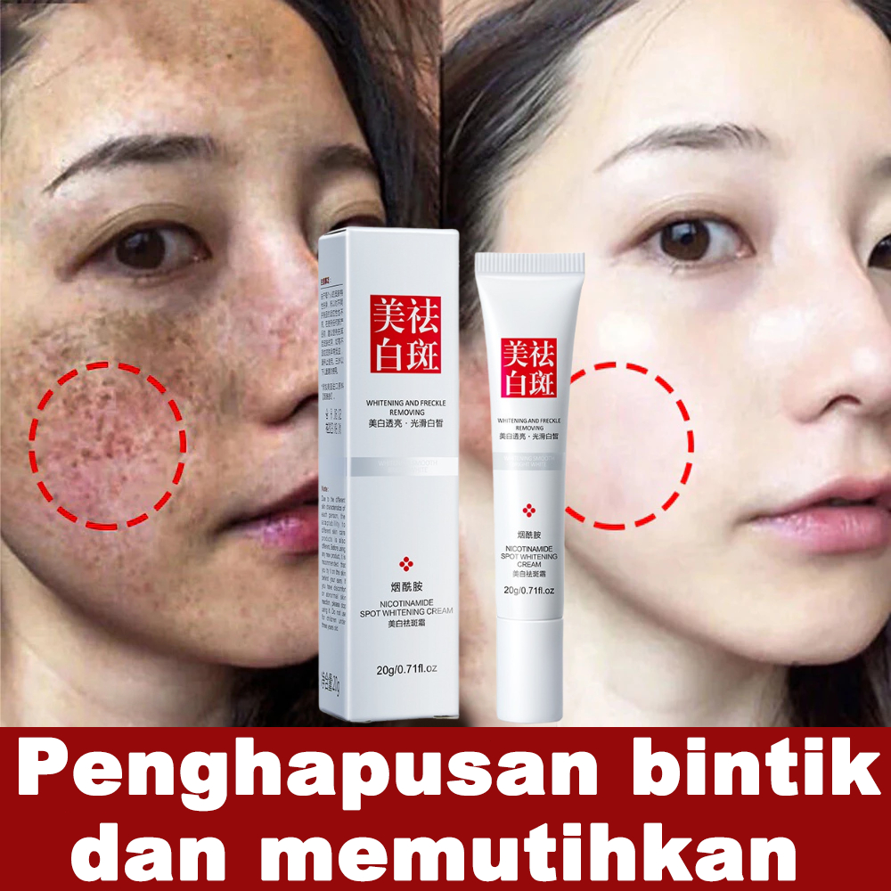 Jual Krim pemutih wajah flek hitam cream penghilang flek hitam salep melasma 20g niacinamide ...