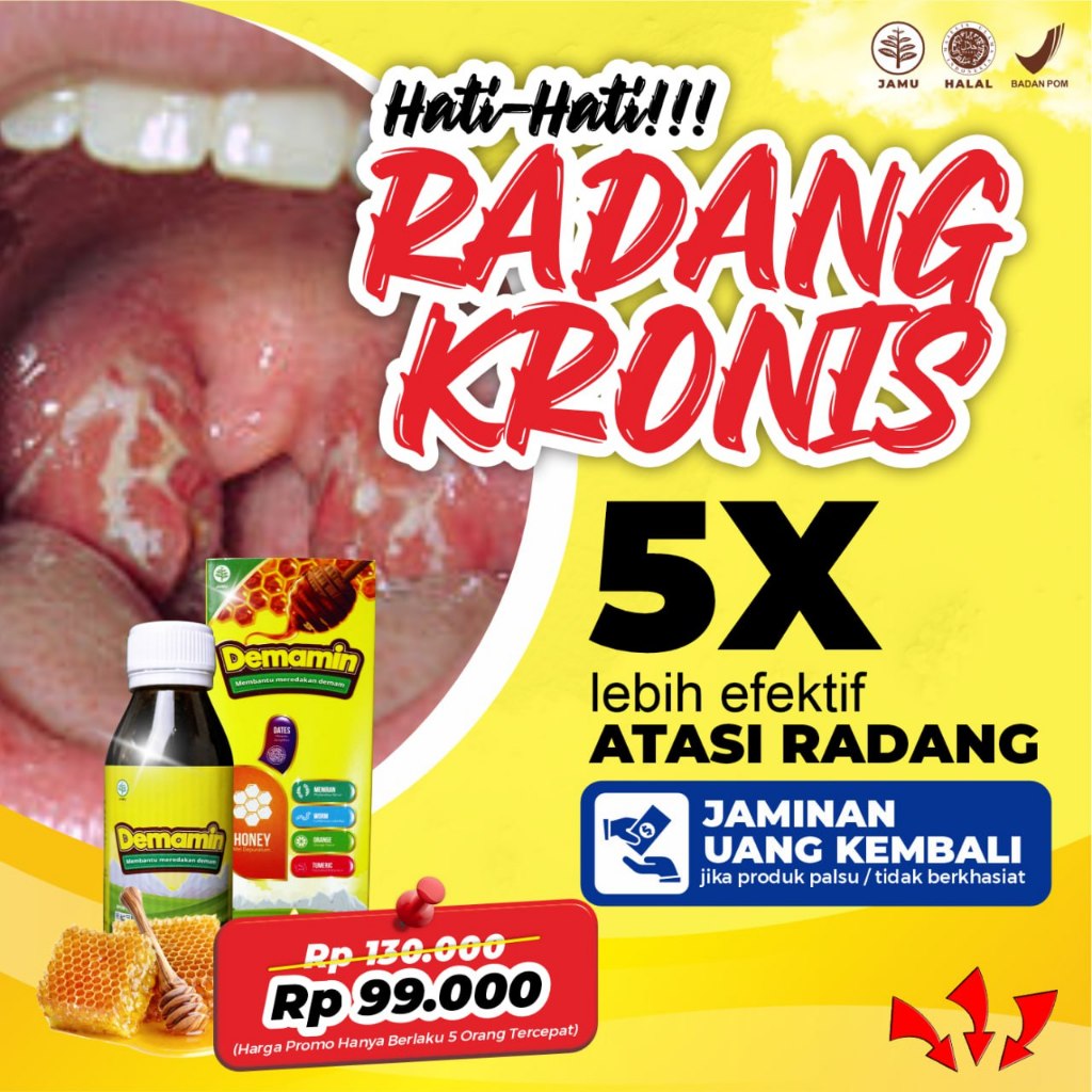 Jual Demamin Solusi Atasi Radang Tenggorokan dan Saluran Pernafasan ...