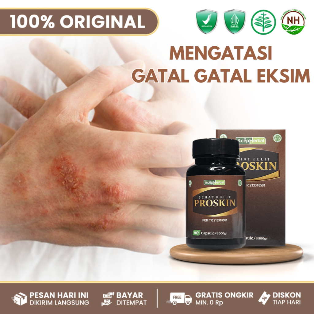 Jual Proskin 100% Asli 60 Kapsul - Obat Gatal Gatal - Obat Eksim Atau ...