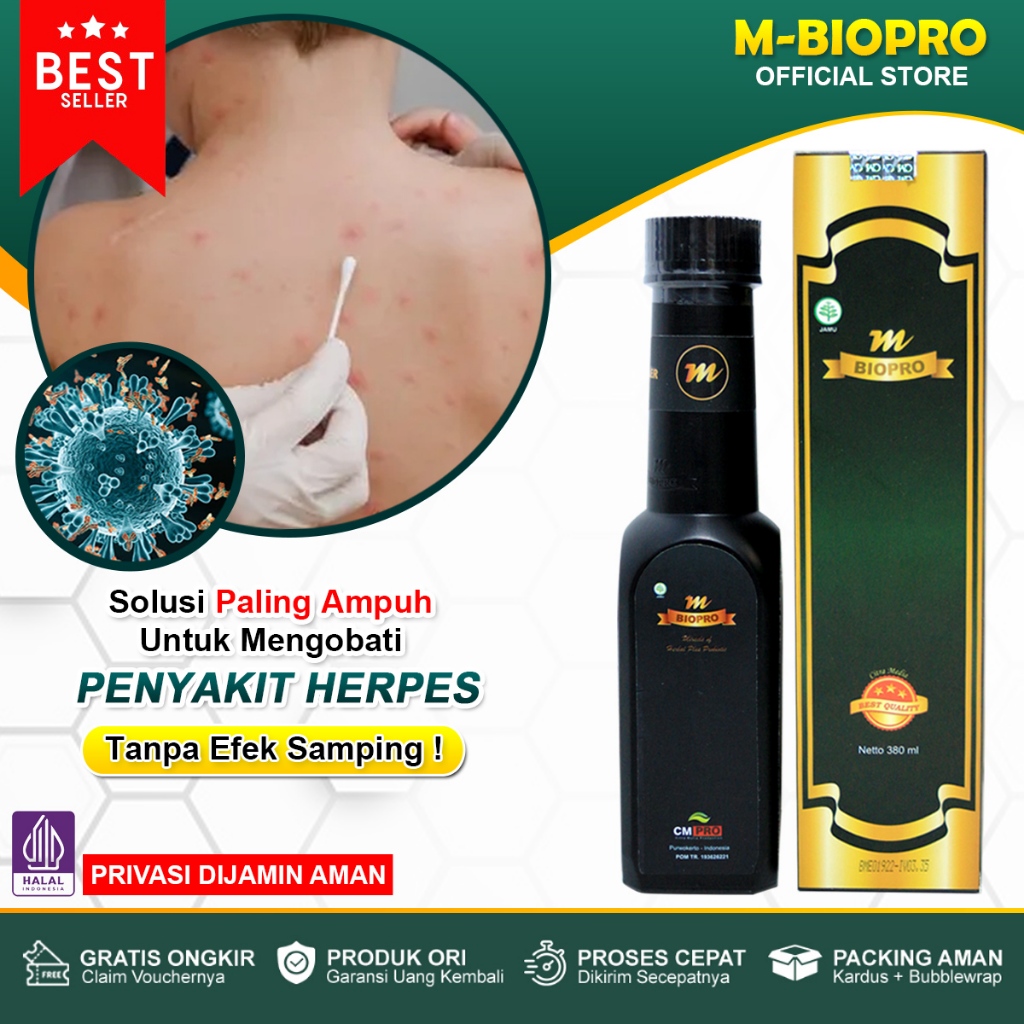 Jual Obat Herpes Kulit Gatal Berair Menyebar - Eksim Kering Menahun ...