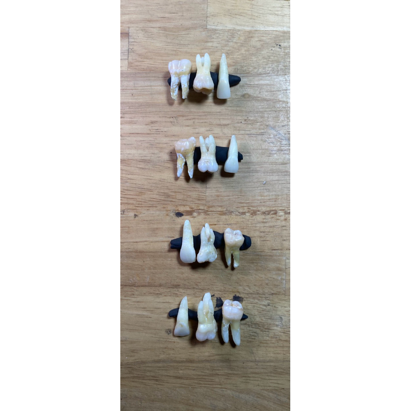 Jual SET ENDO UI | GIGI PRAKTIKUM | Shopee Indonesia