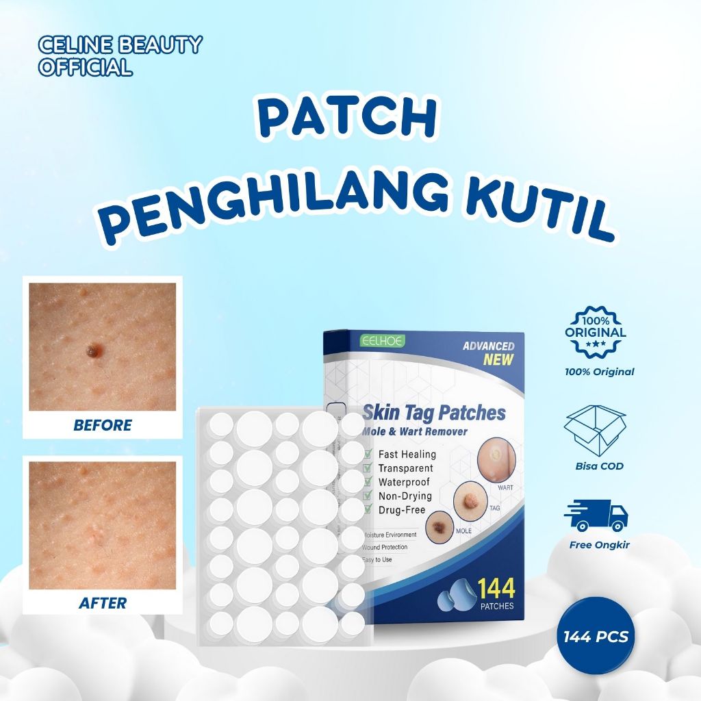 Jual EELHOE 144pcs Stiker Penghilang Kutil Tahi Lalat Wart Removal ...