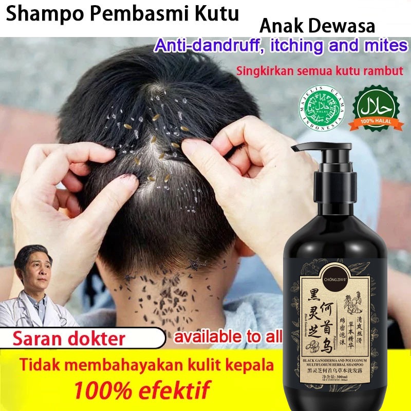 Jual Sampo Kutu Rambut, Anti Gatal&Ketombe, MenghilangKutu, Mengobati Lumut Kulit Kepala, Sampo ...