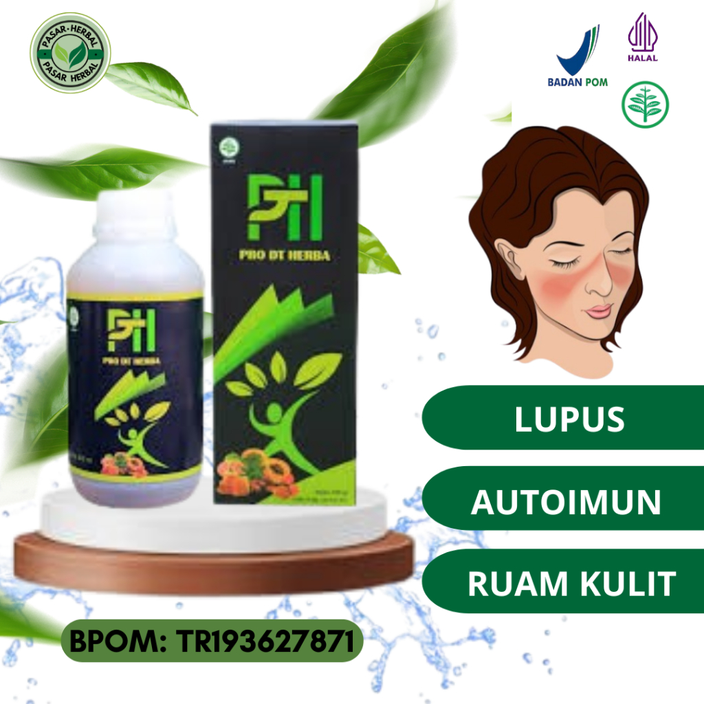 Jual Obat Lupus Autoimun Psoriasis Ruam Wajah Nyeri Sendi Paling Ampuh ...