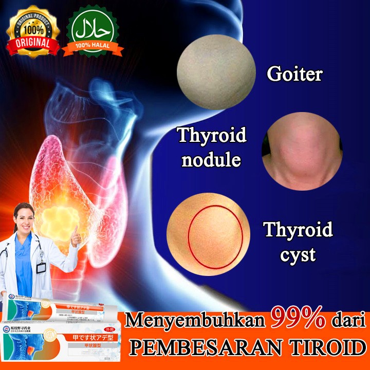 Jual Salep tiroid Krim tiroid salep benjolan ampuh 35g Gondok Kelenjar ...