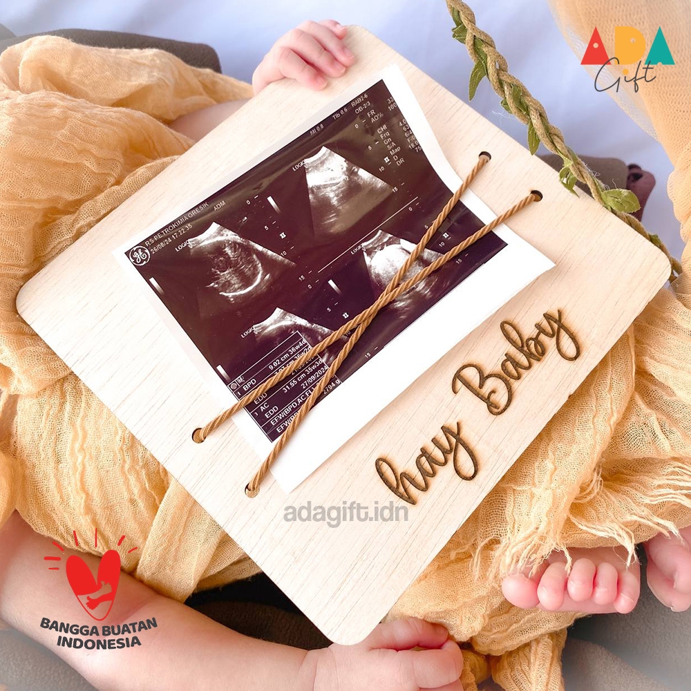 Jual READY CUSTOM PHOTO BOARD | Baby Photo Frame with Custom Text ...