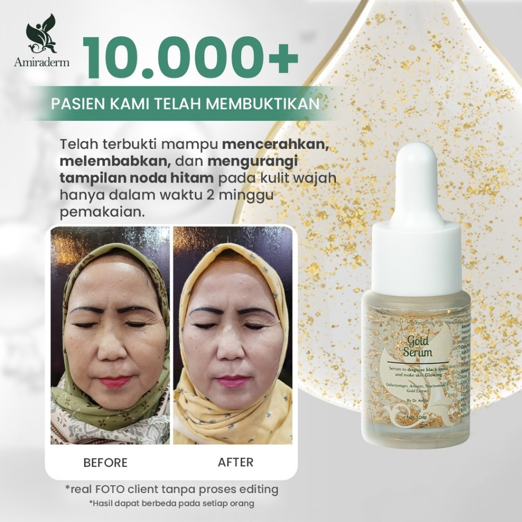 Jual Paket 3 Pcs Amiraderm Glowing Serum with Gold 10ml - Skin ...